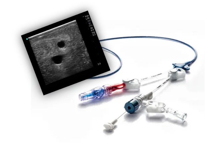Curso teórico-práctico de punción ecoguiada por inserción, cuidado y mantenimiento de catéter ...